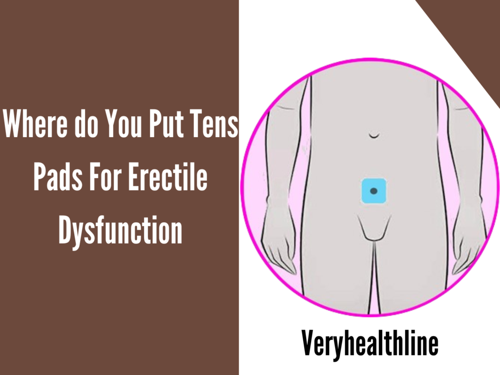 Where Do You Put Tens Pads For Erectile Dysfunction A Comprehensive Guide